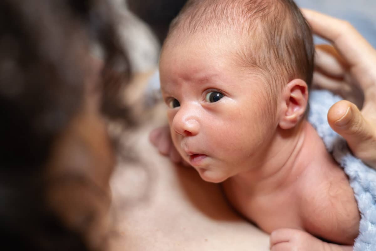 Does your baby have plagiocephally? - Western Kids Health